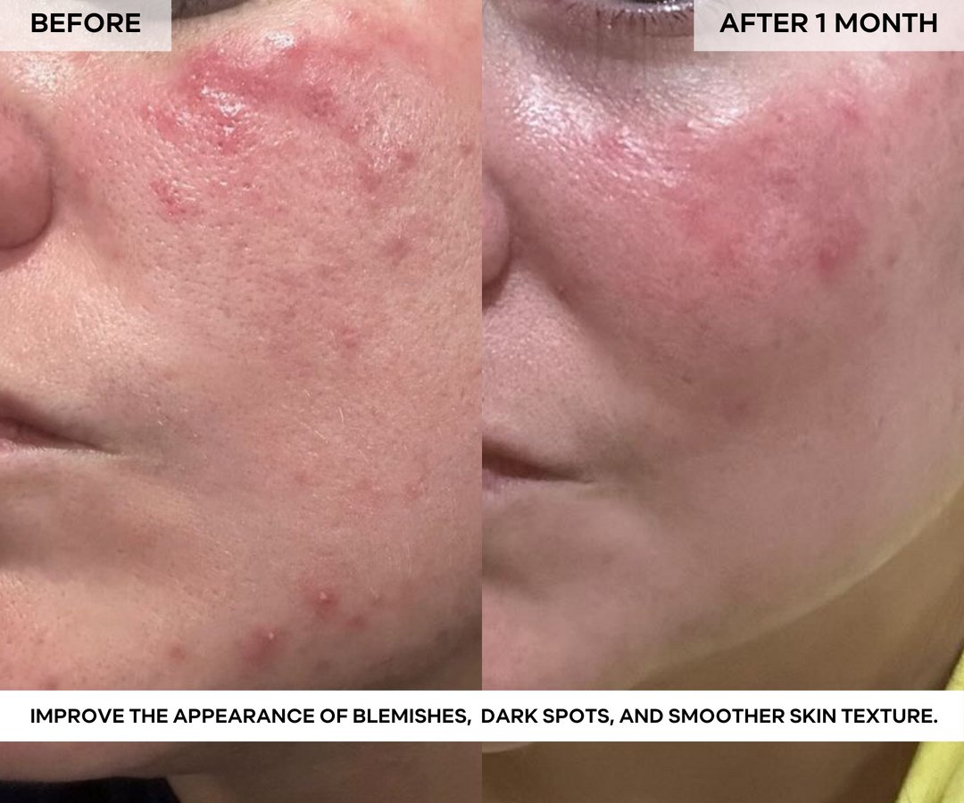 BEAUTY POPS™ Glow Enzyme Frozen Mask Refill – Love and pebble